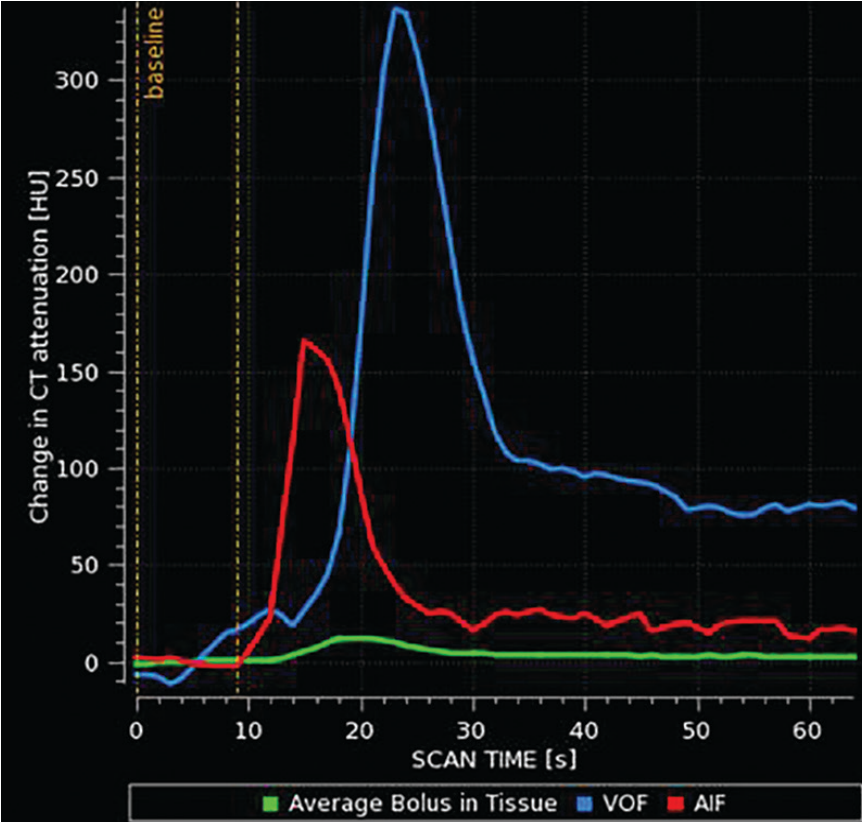(2019)RAPID Automated CT Perfusion in Clinical Practice